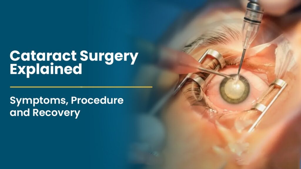 Cataract Surgery Explained: Step-by-Step Guide for Patients